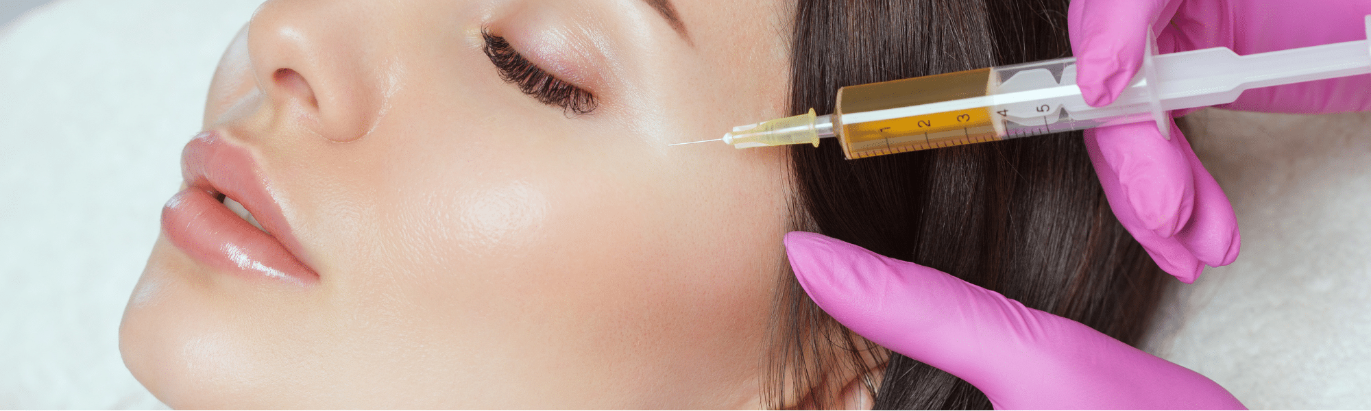 What is PRP Filler - 7740