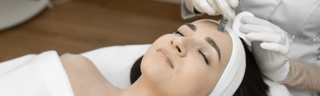 Microneedling Atlanta GA - Injectables Therapy GA